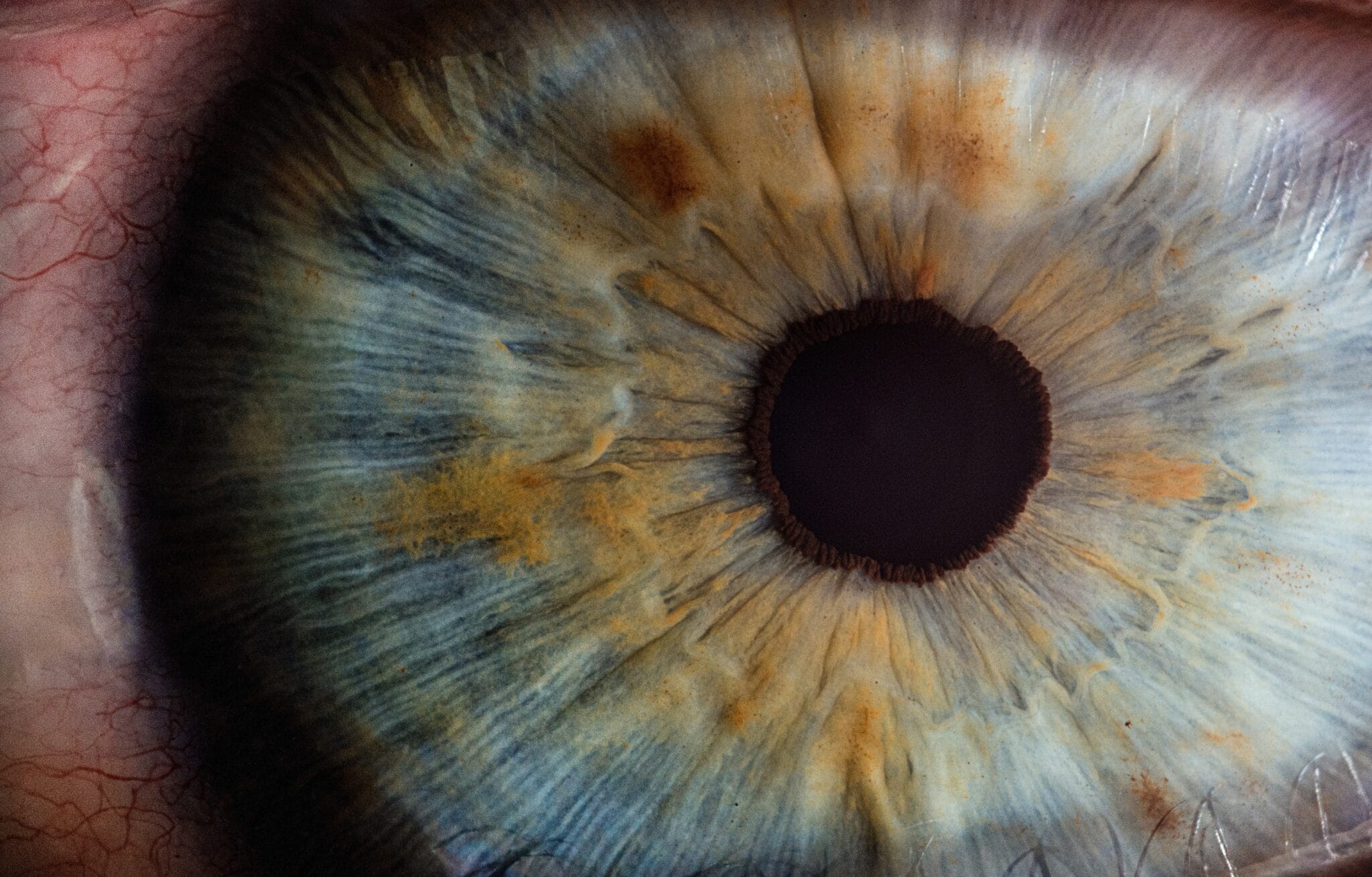 How Does LASIK Work? - Laser Eye Surgery Facts